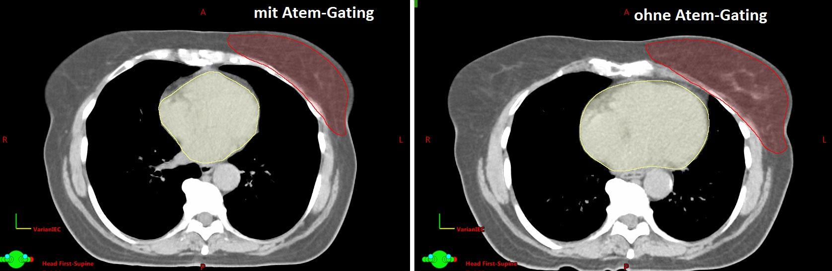 Unser Therapieangebot | Strahlentherapie Halle